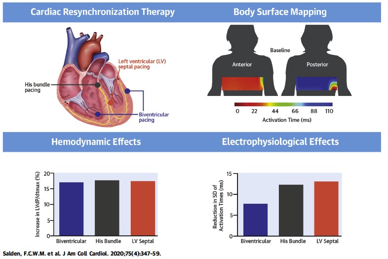 Heart Failure - Research - Maastricht University